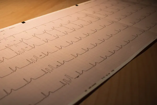 Understanding The Science Behind ECG Technology - Tech Journal